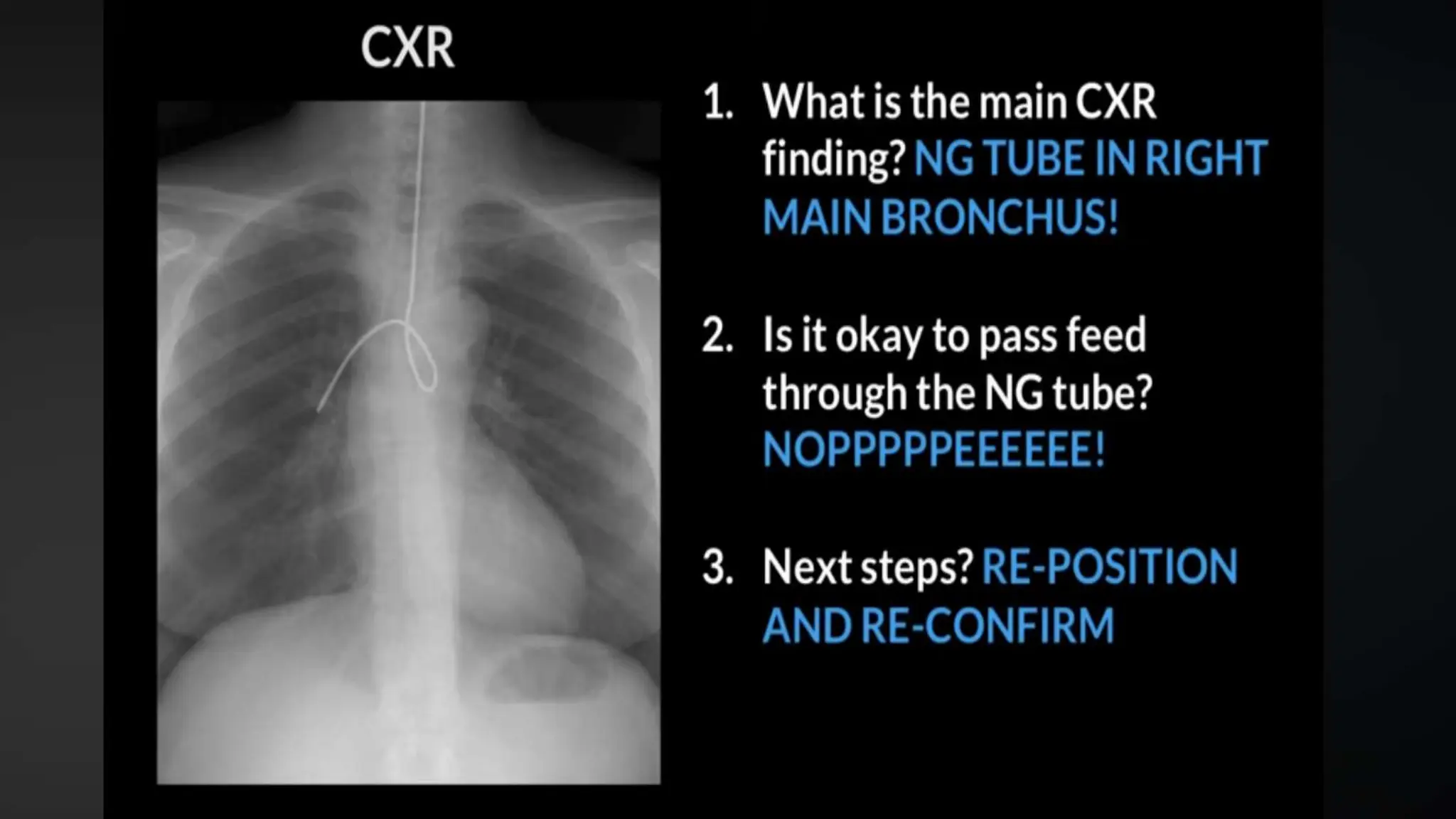Chest xray pathologies interpretation.pptx | Lung and Respiratory ...