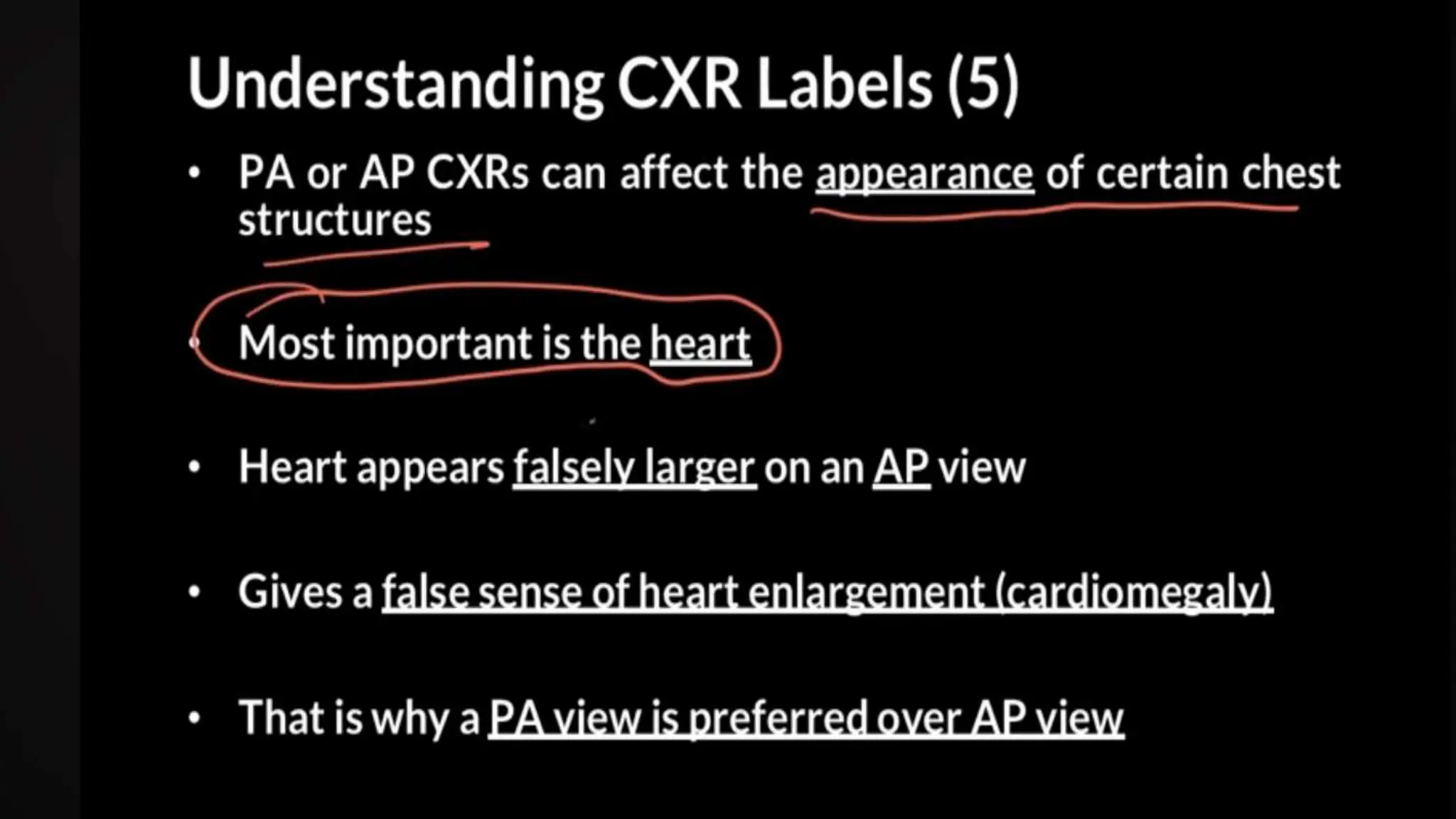 Chest xray pathologies interpretation.pptx | Lung and Respiratory ...