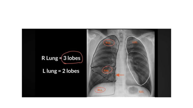 Chest xray pathologies interpretation.pptx | Lung and Respiratory Health | Diseases and Conditions