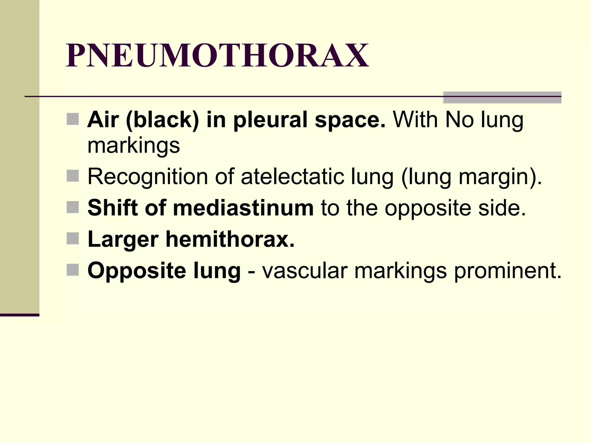 Chest x ray pathology | PPT
