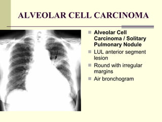 Chest x ray pathology | PPT