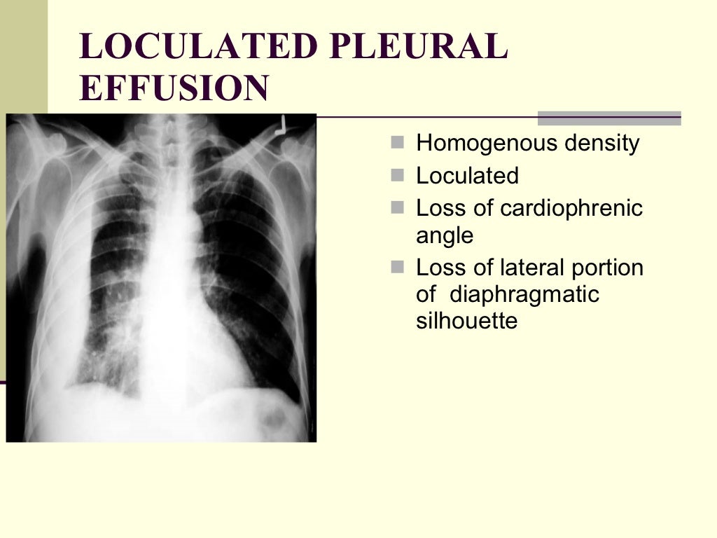 Chest x ray pathology