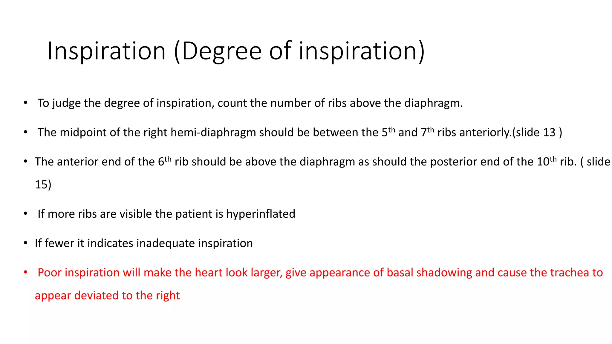 Chest X ray ppt.ppt