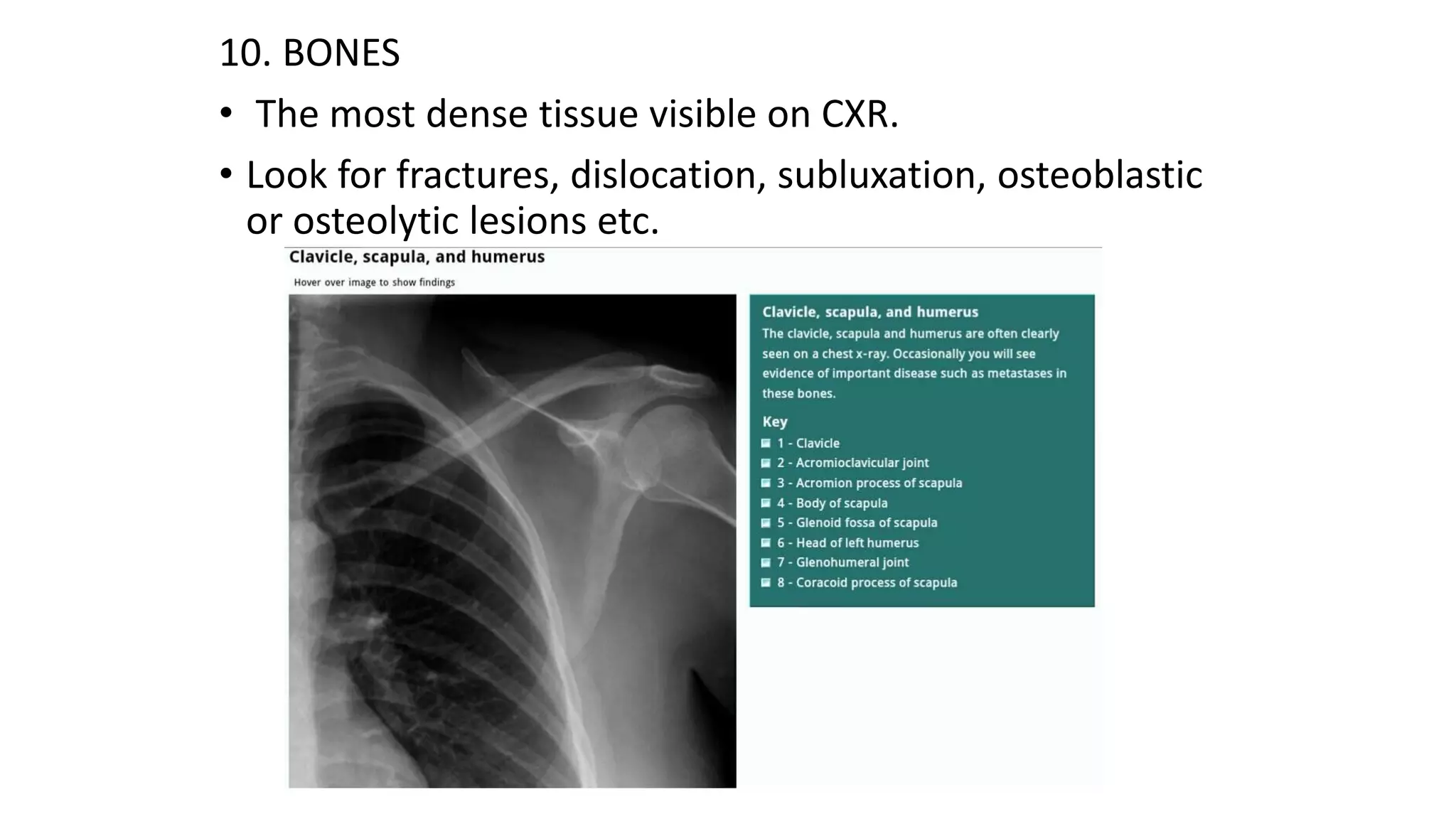 Chest X ray ppt.ppt
