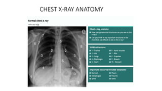 Chest X ray ppt.ppt