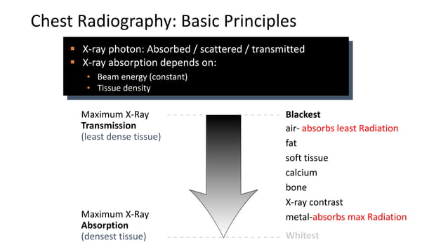 Chest X ray ppt.ppt