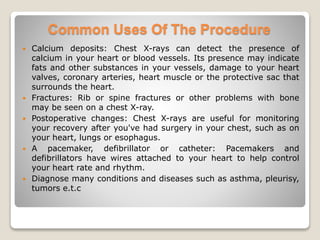 CHEST XRAY RDG 303.pptx