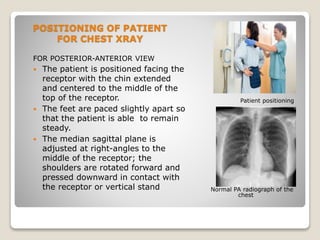 CHEST XRAY RDG 303.pptx