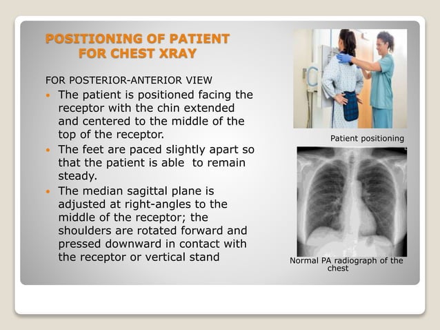 CHEST XRAY RDG 303.pptx
