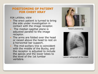 CHEST XRAY RDG 303.pptx