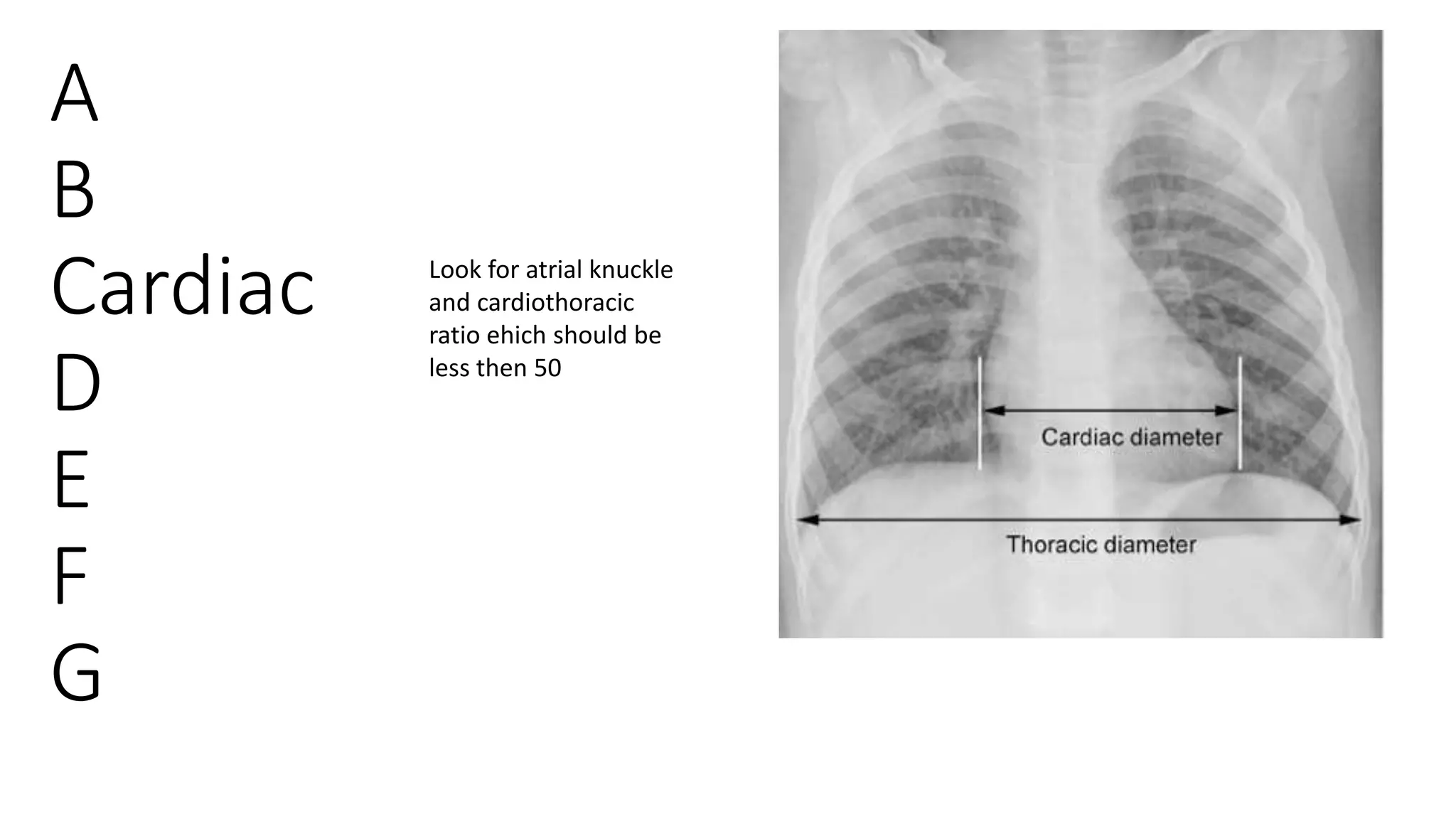 Chest xrays how to interpret. photos | PPT