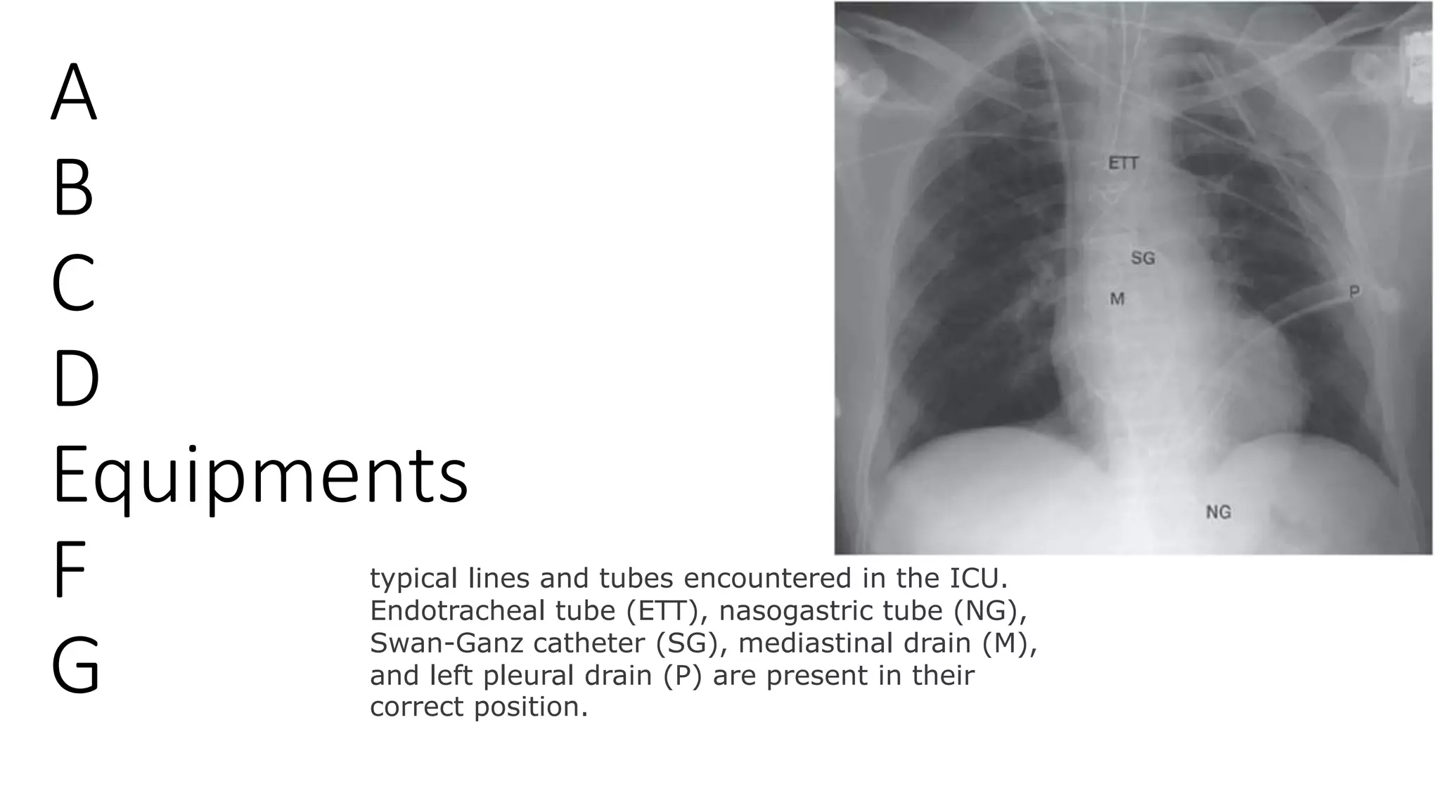 Chest xrays how to interpret. photos | PPT