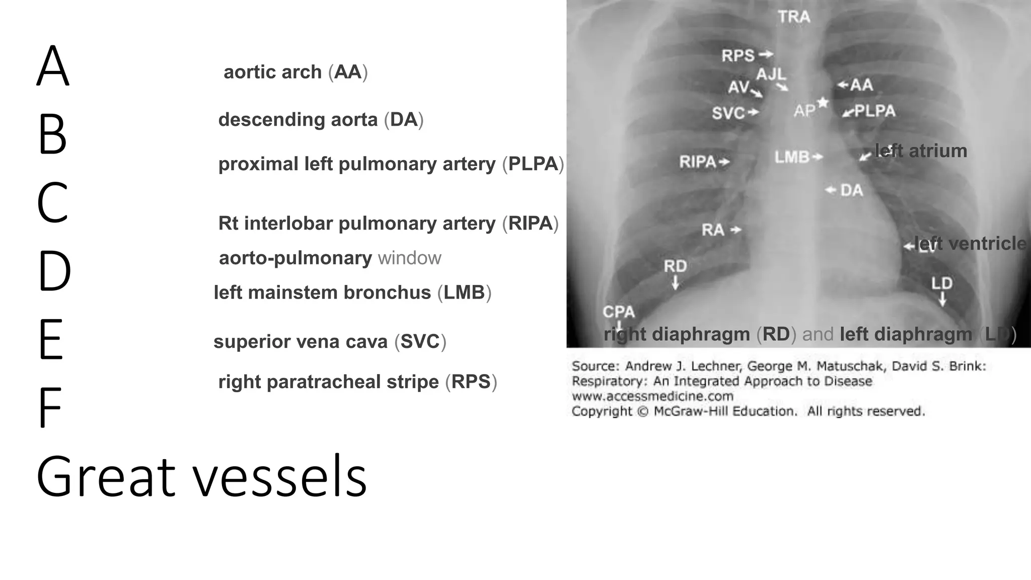 Chest xrays how to interpret. photos | PPT