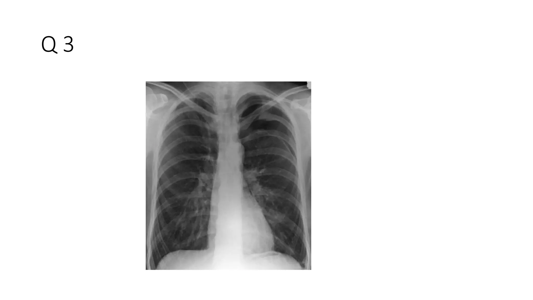 Chest xrays how to interpret. photos | PPT