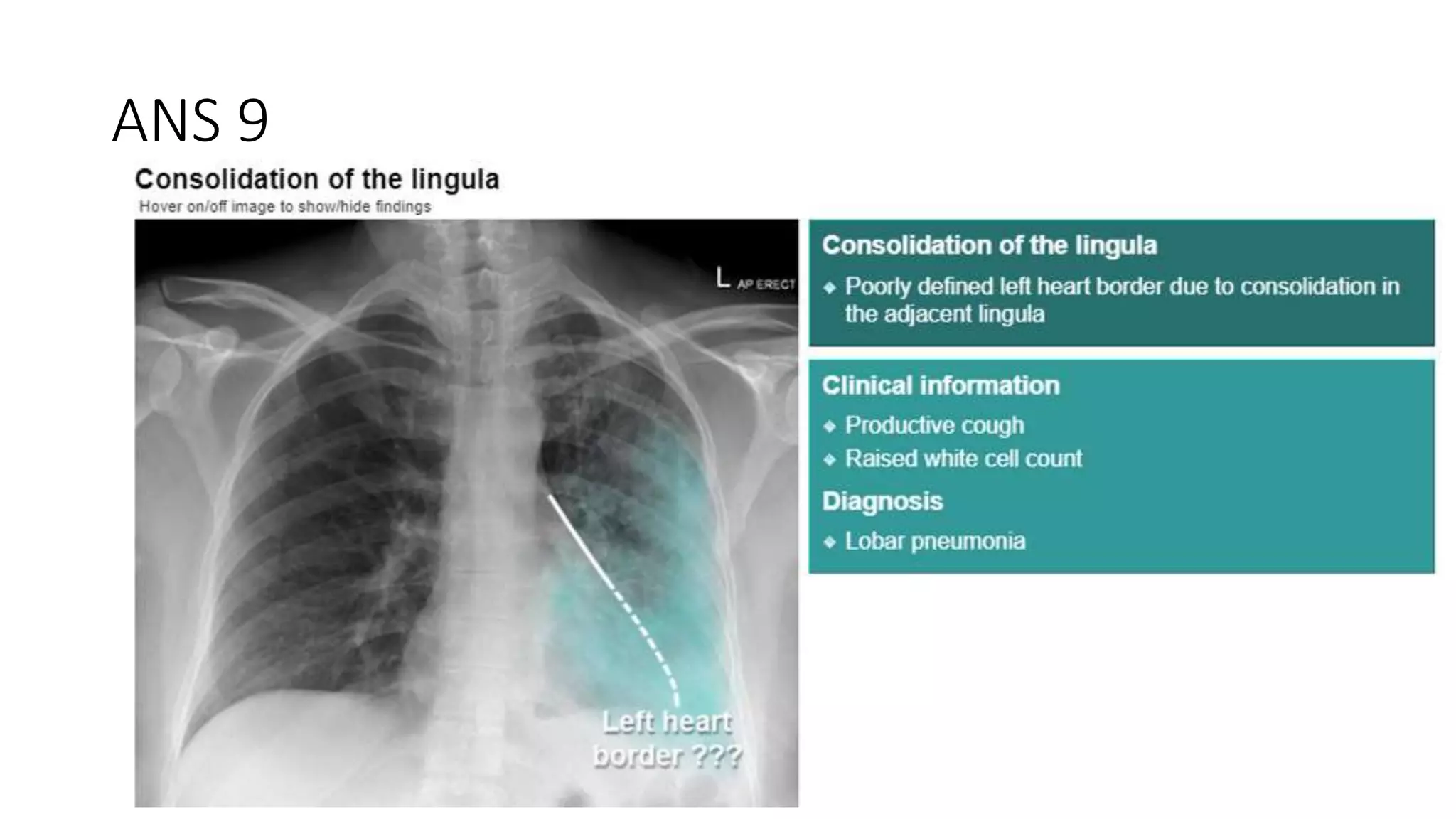 Chest xrays how to interpret. photos | PPT
