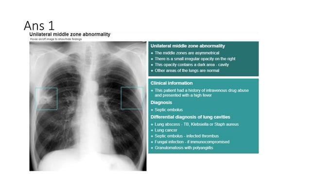 Chest xrays how to interpret. photos | PPT