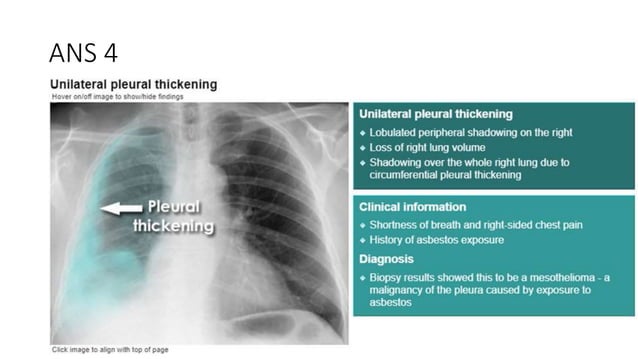 Chest xrays how to interpret. photos | PPT