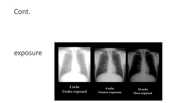 Chest xrays how to interpret. photos | PPT