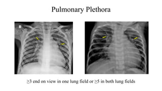 Chest X rays.pptx