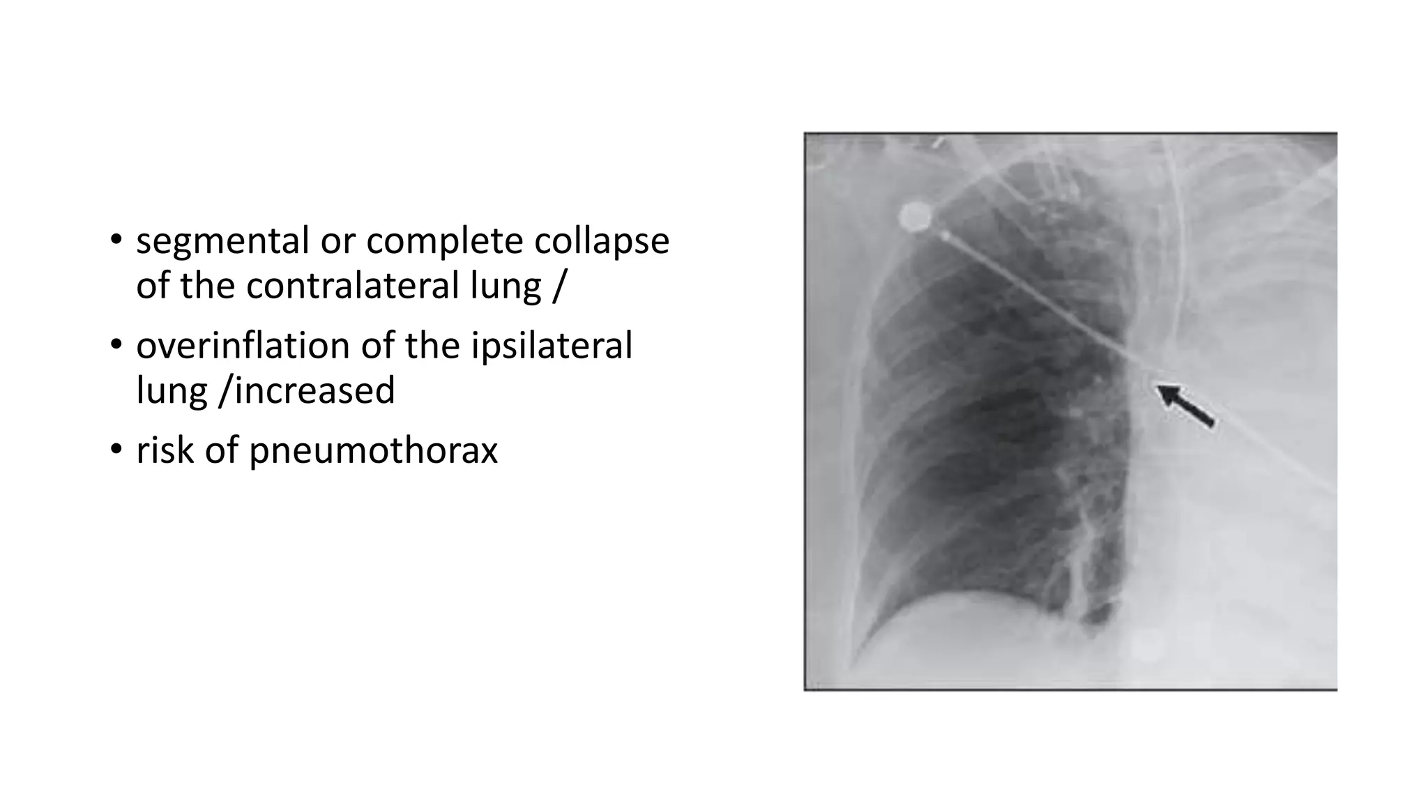 Chest x rays swati | PPTX