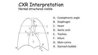 Chest x rays swati | PPTX