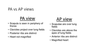 Chest x rays swati | PPTX