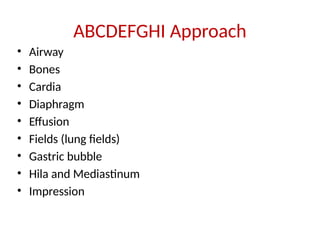 chest_xray ug class for undergraduates useful | PPTX