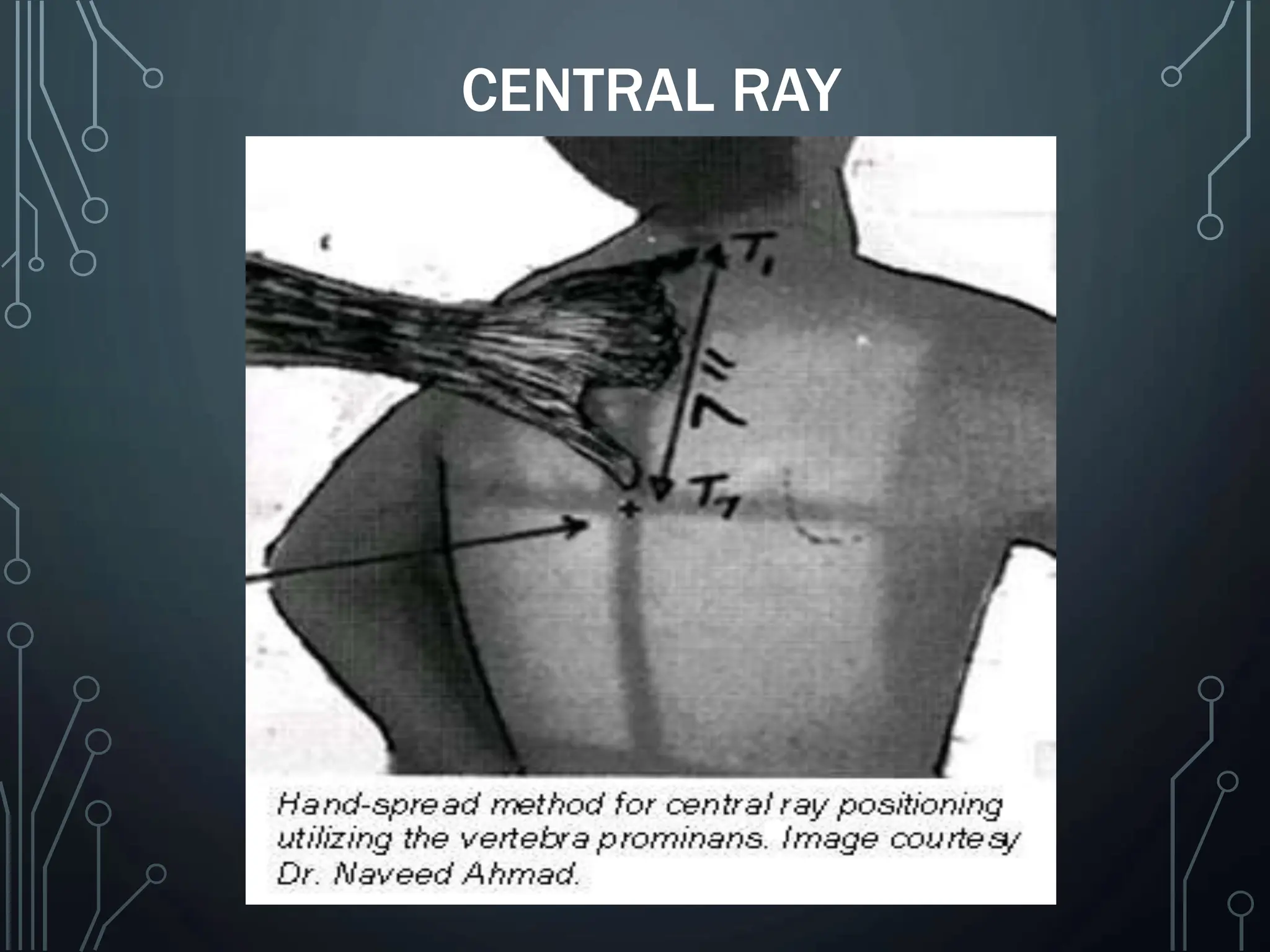 Basic Chest X ray Views - AP, PA & Lateral etc . pptx | PPTX