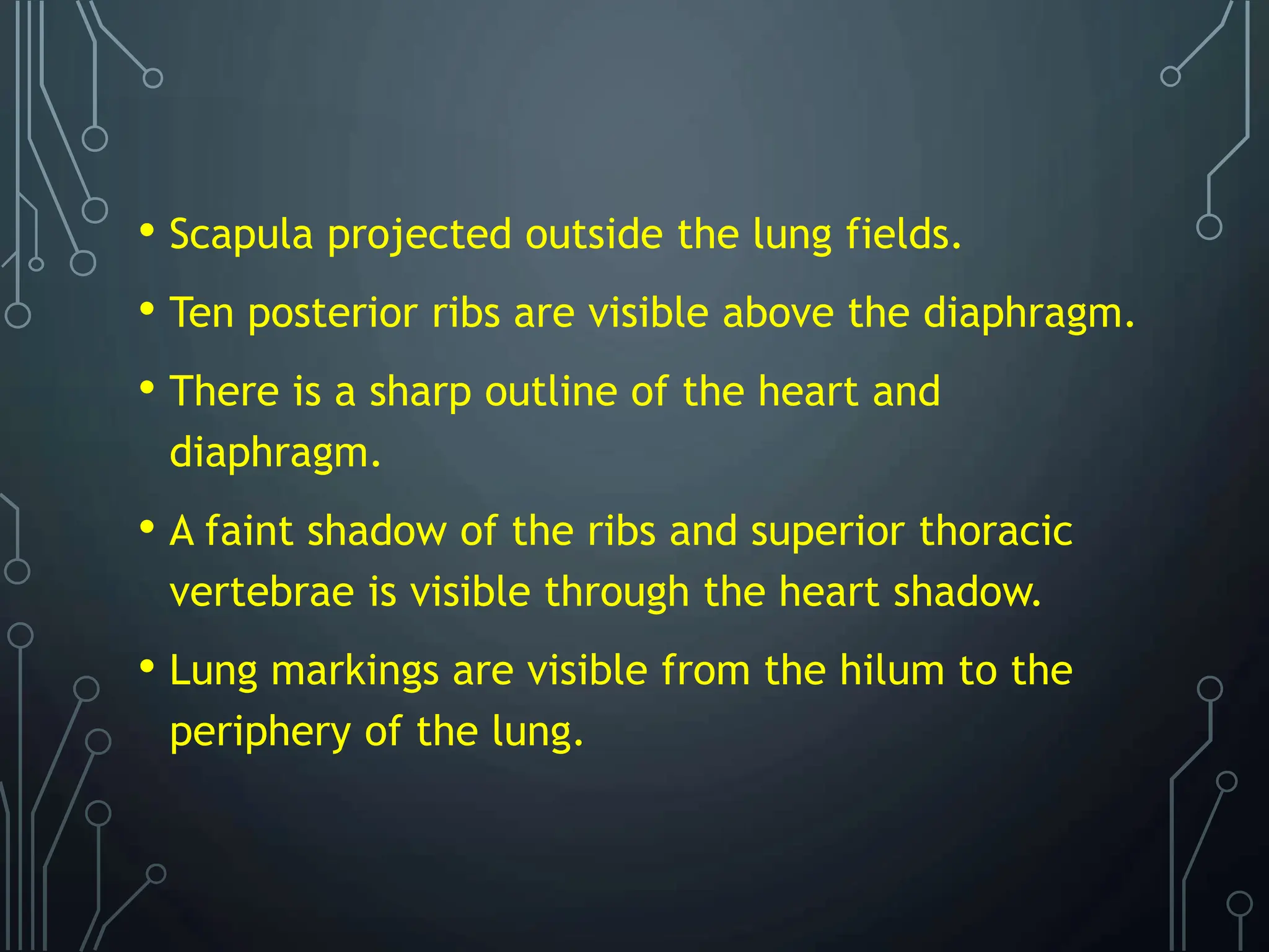 Basic Chest X ray Views - AP, PA & Lateral etc . pptx | PPTX