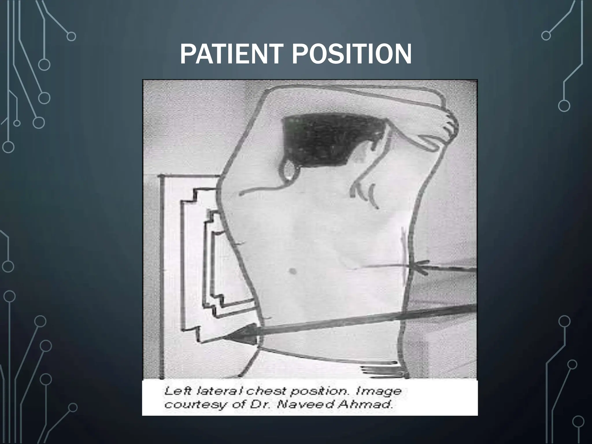 Basic Chest X ray Views - AP, PA & Lateral etc . pptx | PPTX