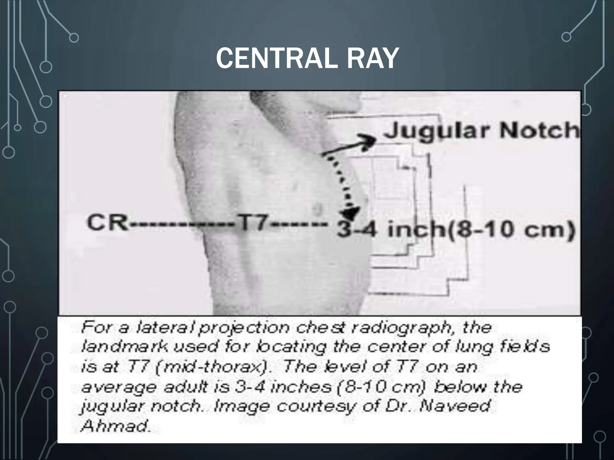 Basic Chest X ray Views - AP, PA & Lateral etc . pptx | PPTX