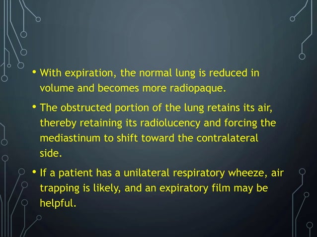 Basic Chest X ray Views - AP, PA & Lateral etc . pptx | PPTX