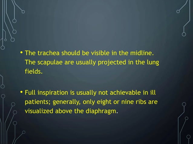 Basic Chest X ray Views - AP, PA & Lateral etc . pptx | PPTX
