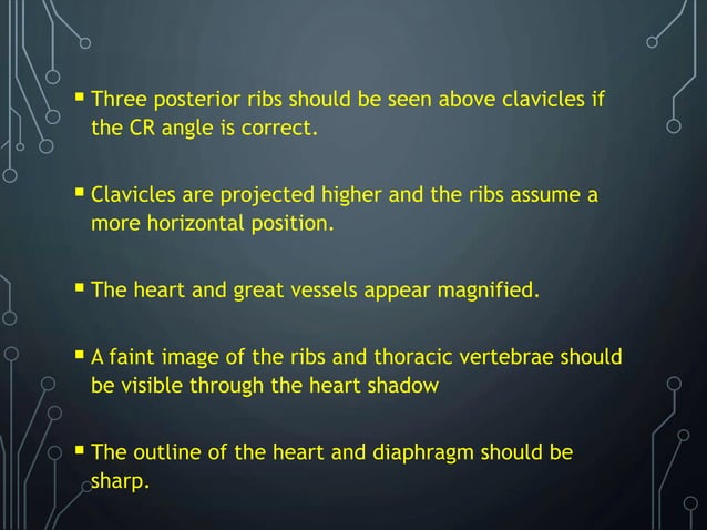 Basic Chest X ray Views - AP, PA & Lateral etc . pptx | PPTX