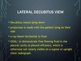 Basic Chest X ray Views - AP, PA & Lateral etc . pptx | PPTX