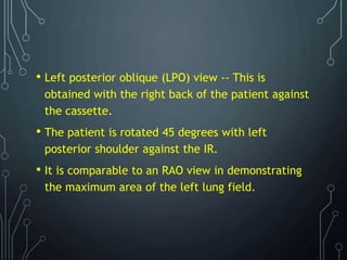 Basic Chest X ray Views - AP, PA & Lateral etc . pptx | PPTX