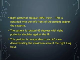 Basic Chest X ray Views - AP, PA & Lateral etc . pptx | PPTX