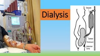 Chetan dialysis ppt | PPT