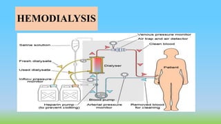 Chetan dialysis ppt | PPT