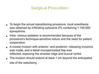 inferior alveolar nerve lateralization | PPTX