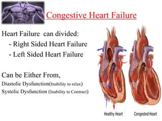 Congestive cardiac Failure | PPTX