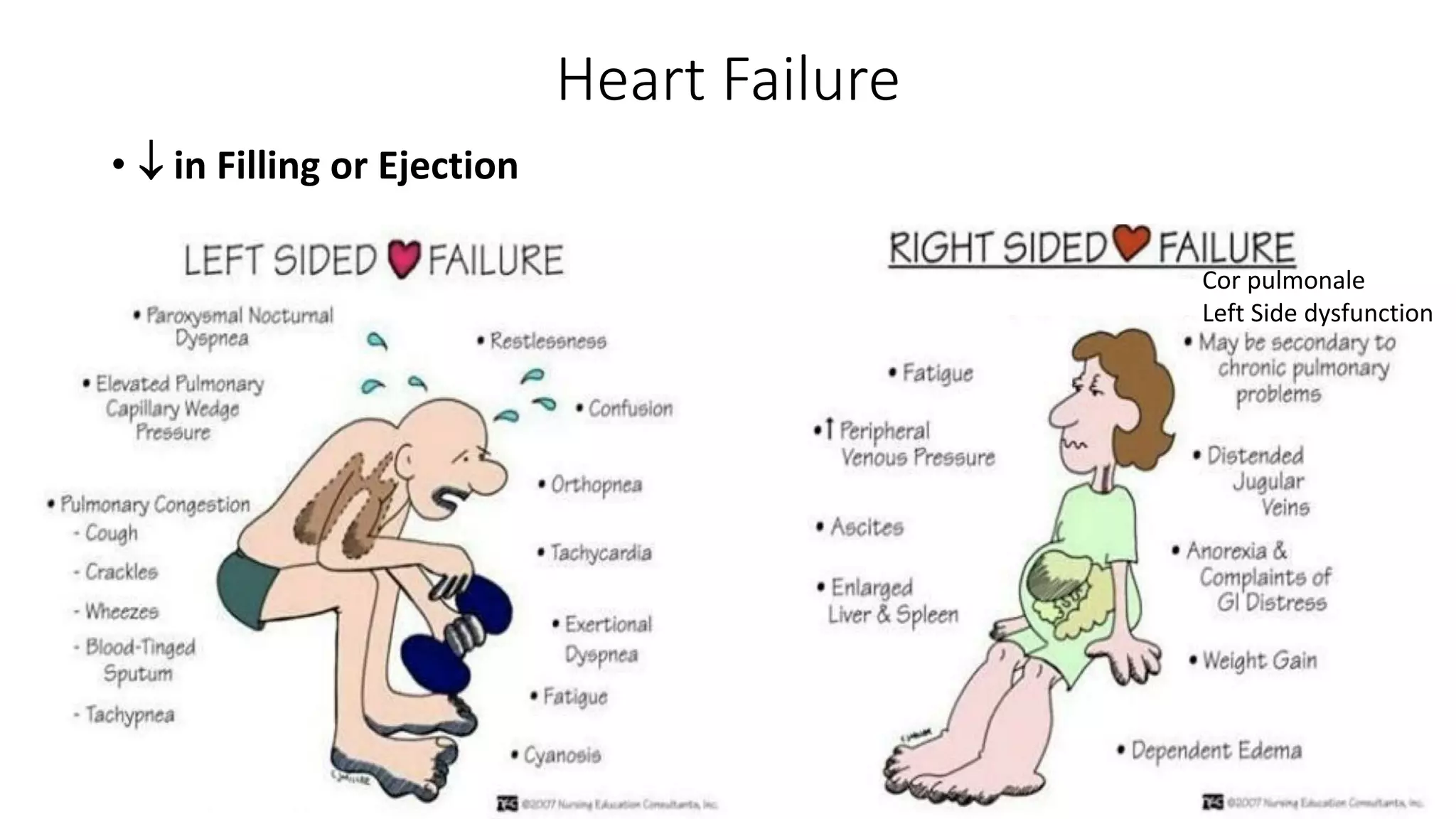 Chronic Heart Failure | PPTX