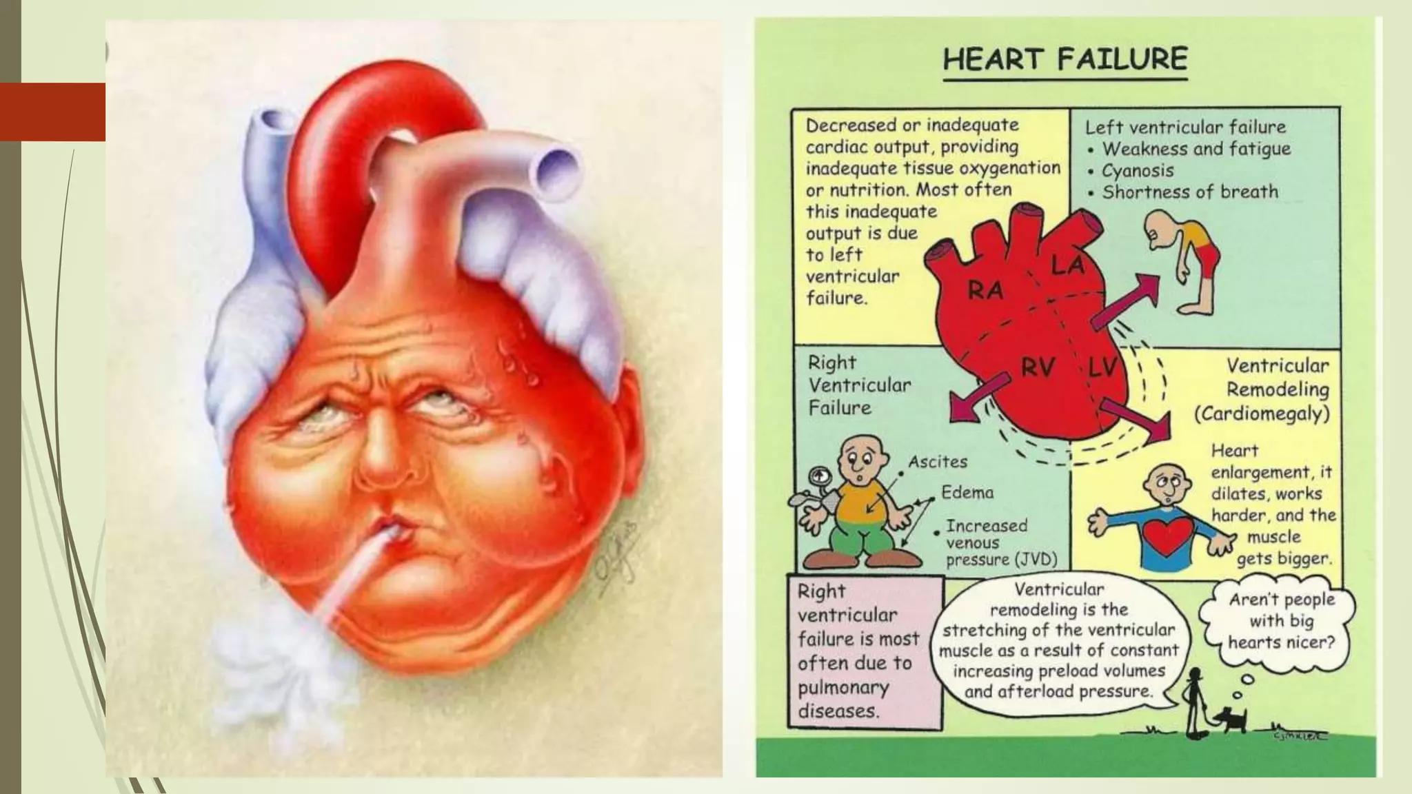 Congestive Heart Failure and Drugs used in CCF by Dr. Pawan | PPTX