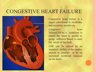 Chf ppn | PPTX