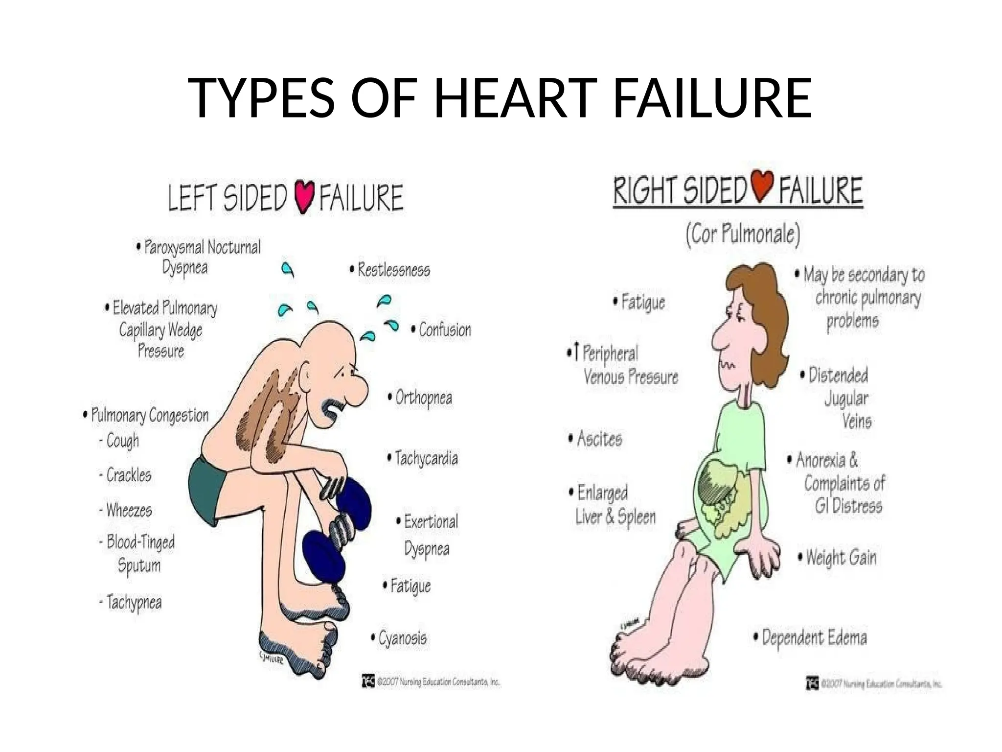 CHF PPT and heart failure classification.pptx