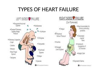 CHF PPT and heart failure classification.pptx