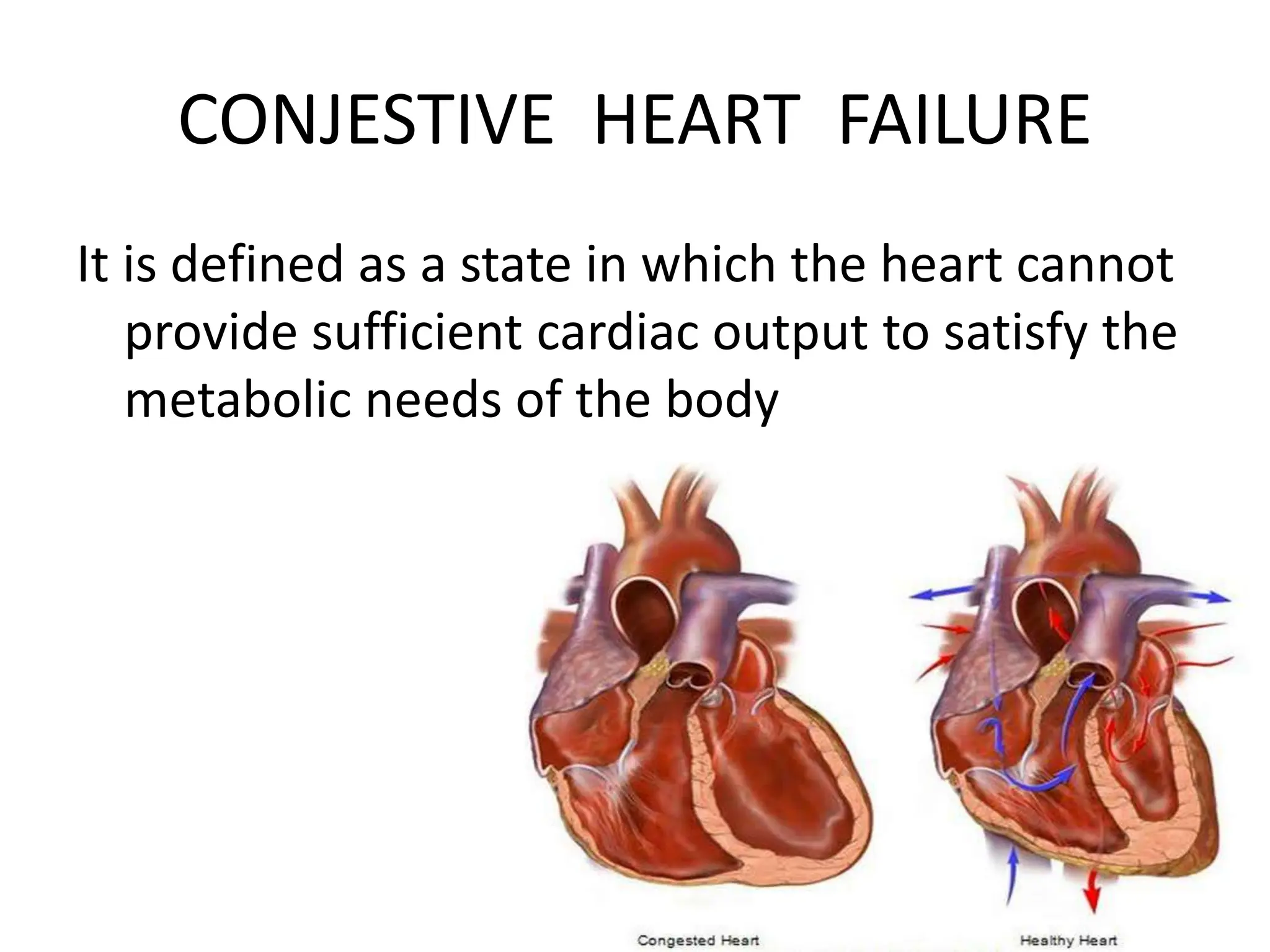 CHF PRESENTATION.pptx