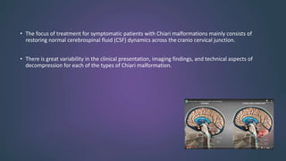 Arnold chiari malformation and types.pptx