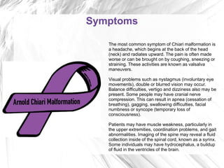 Chiari Malformation | ODP
