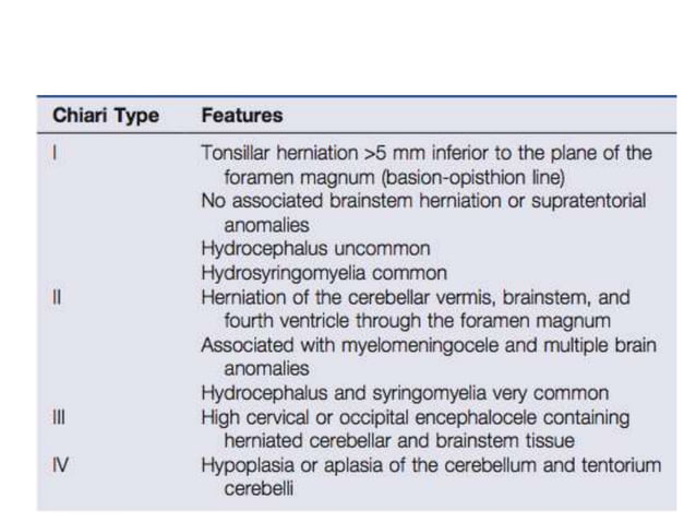chiari malformation mukesh.pptx